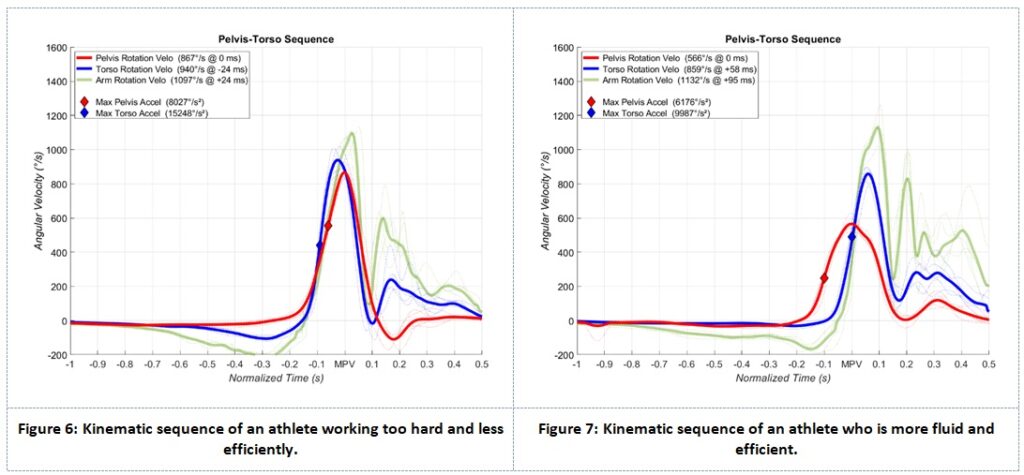 IMU-Based Biomechanical Assessments | Epic Sports Bio